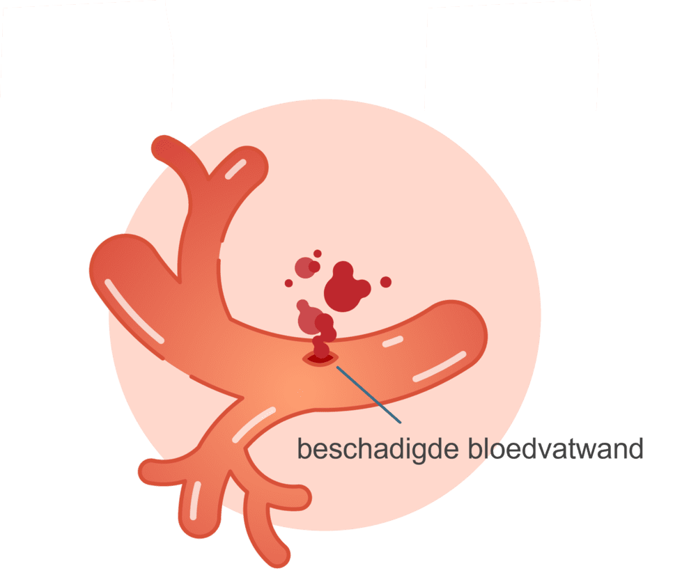 Hoe werkt bloedstolling? | Biologie | Uitleg en Oefeningen